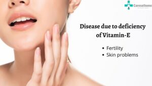 Diseases and Conditions Caused by Vitamin E Deficiency - Cares at Home ...