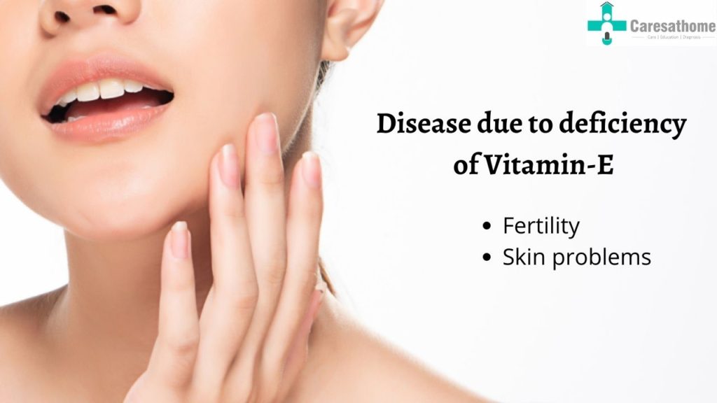 Diseases and Conditions Caused by Vitamin E Deficiency - Cares at Home ...